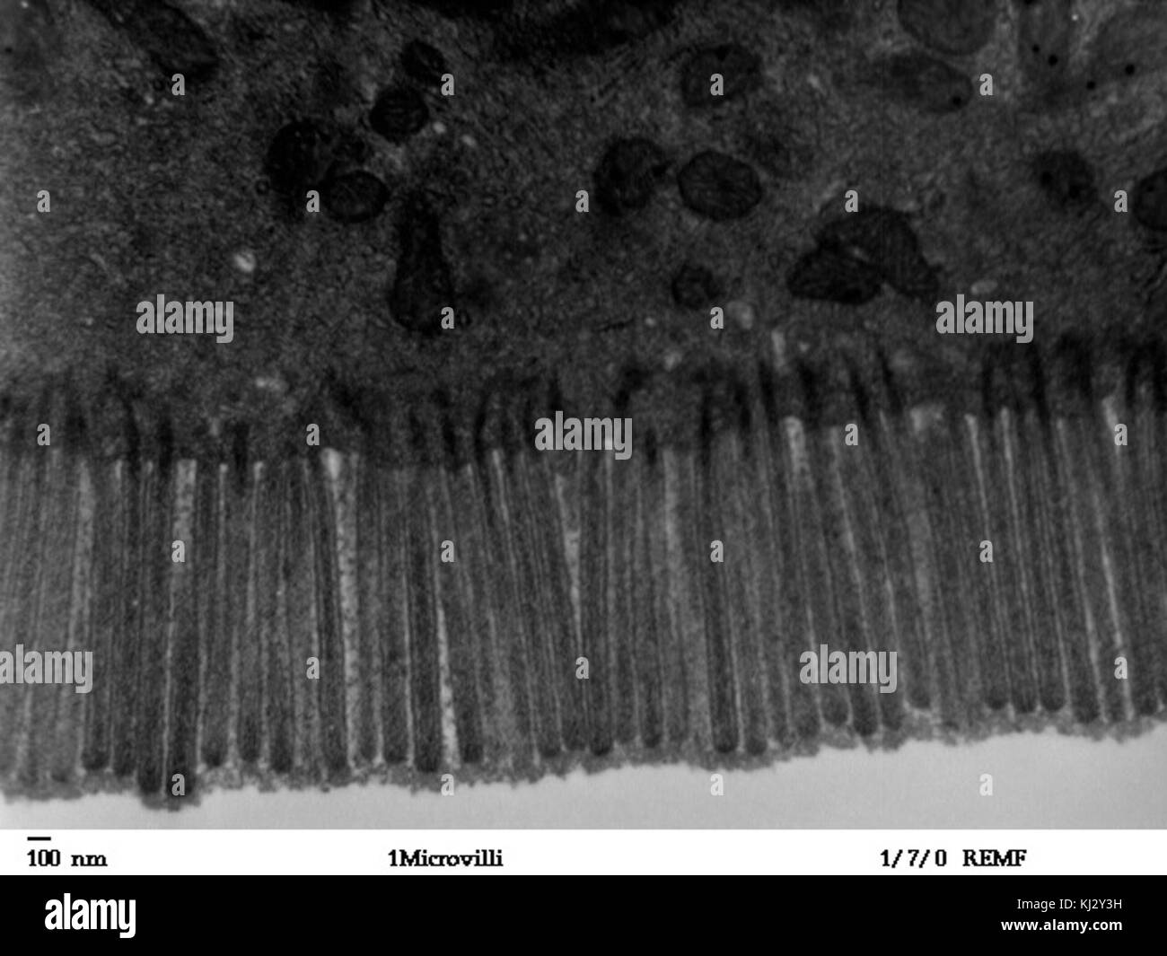 Human jejunum microvilli 1 - TEM Stock Photo - Alamy