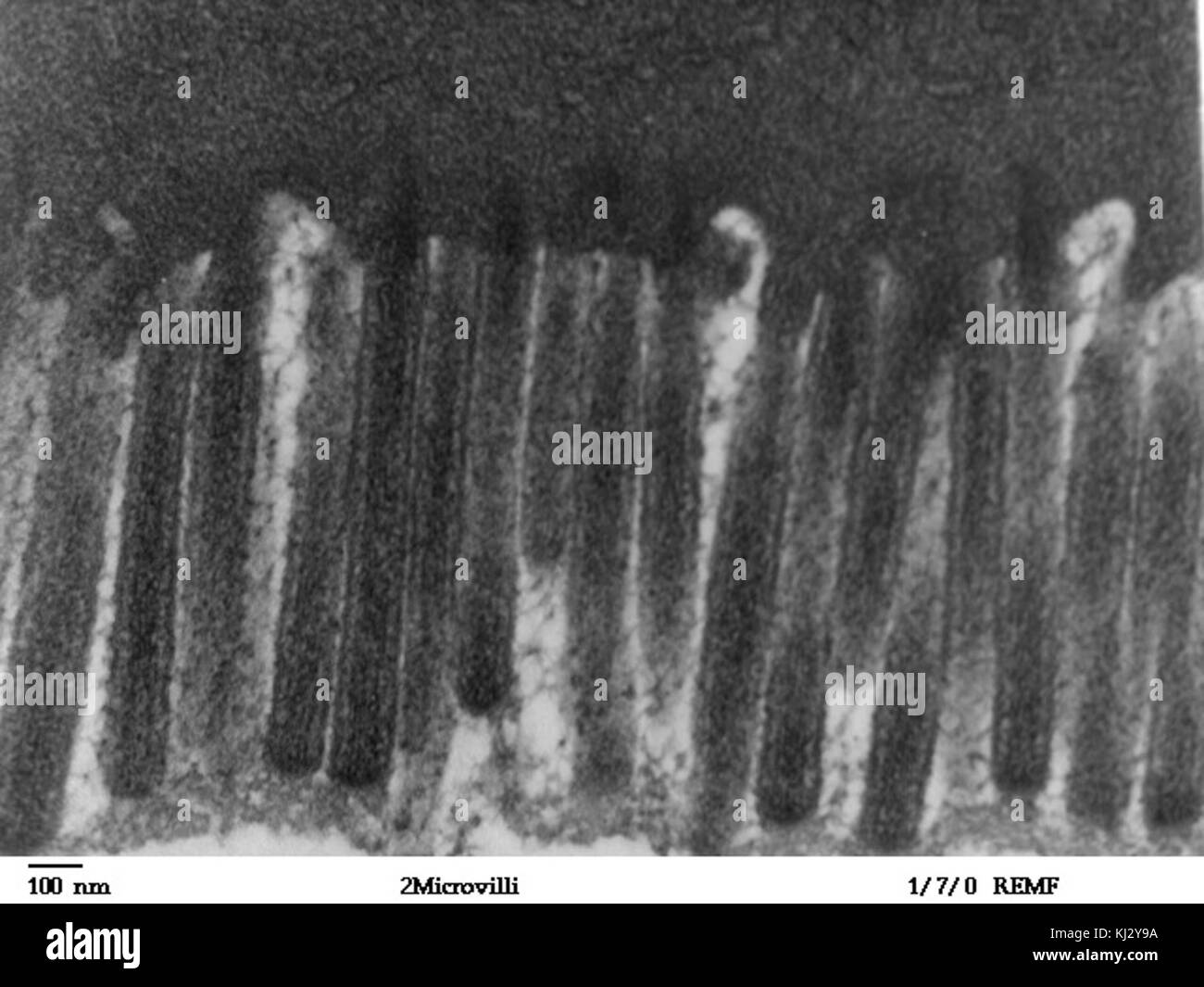 Human jejunum microvilli 2 - TEM Stock Photo - Alamy