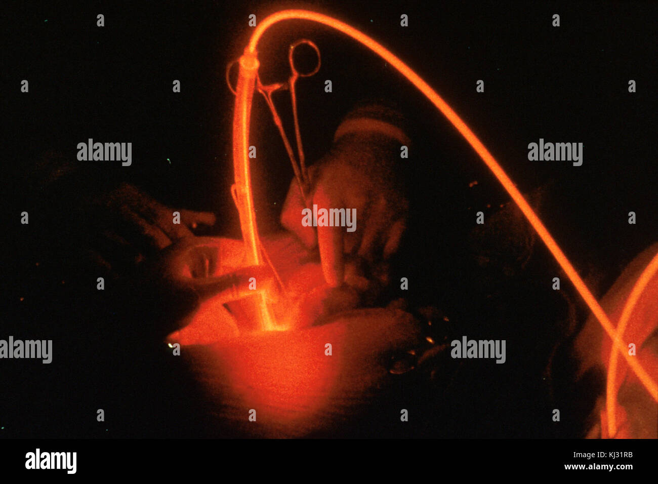 Photodynamic therapy (red Stock Photo - Alamy