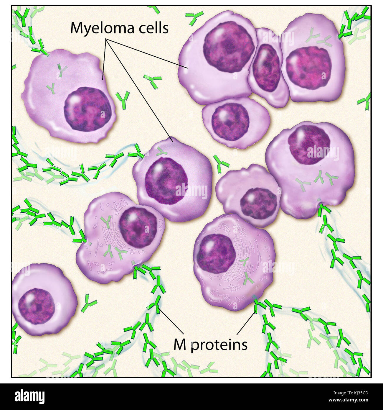 Myeloma cells hi-res stock photography and images - Alamy