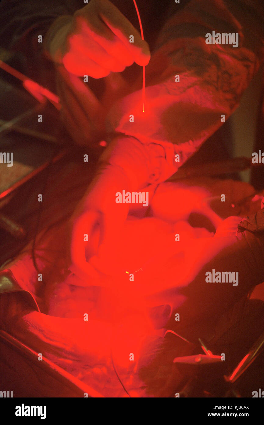 Photodynamic therapy cancer hi-res stock photography and images - Alamy