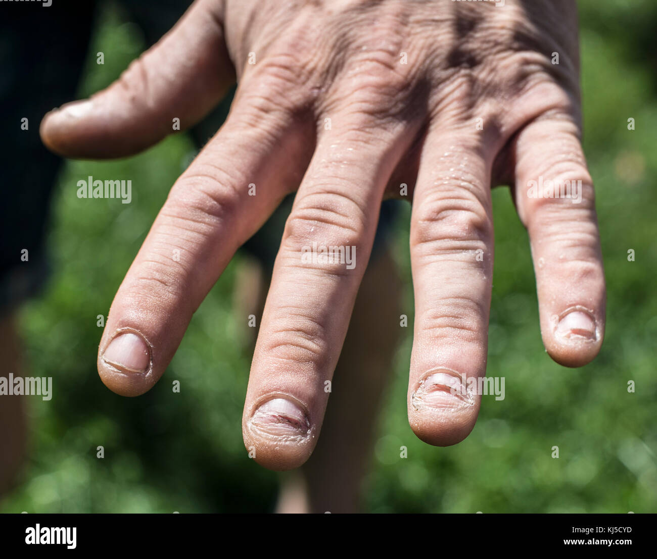 Dirty finger nails hi-res stock photography and images - Alamy