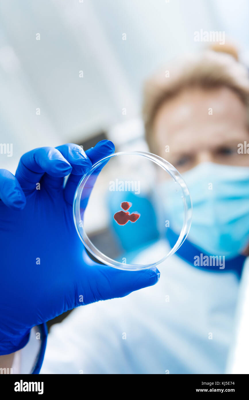 Observing blood hi-res stock photography and images - Alamy