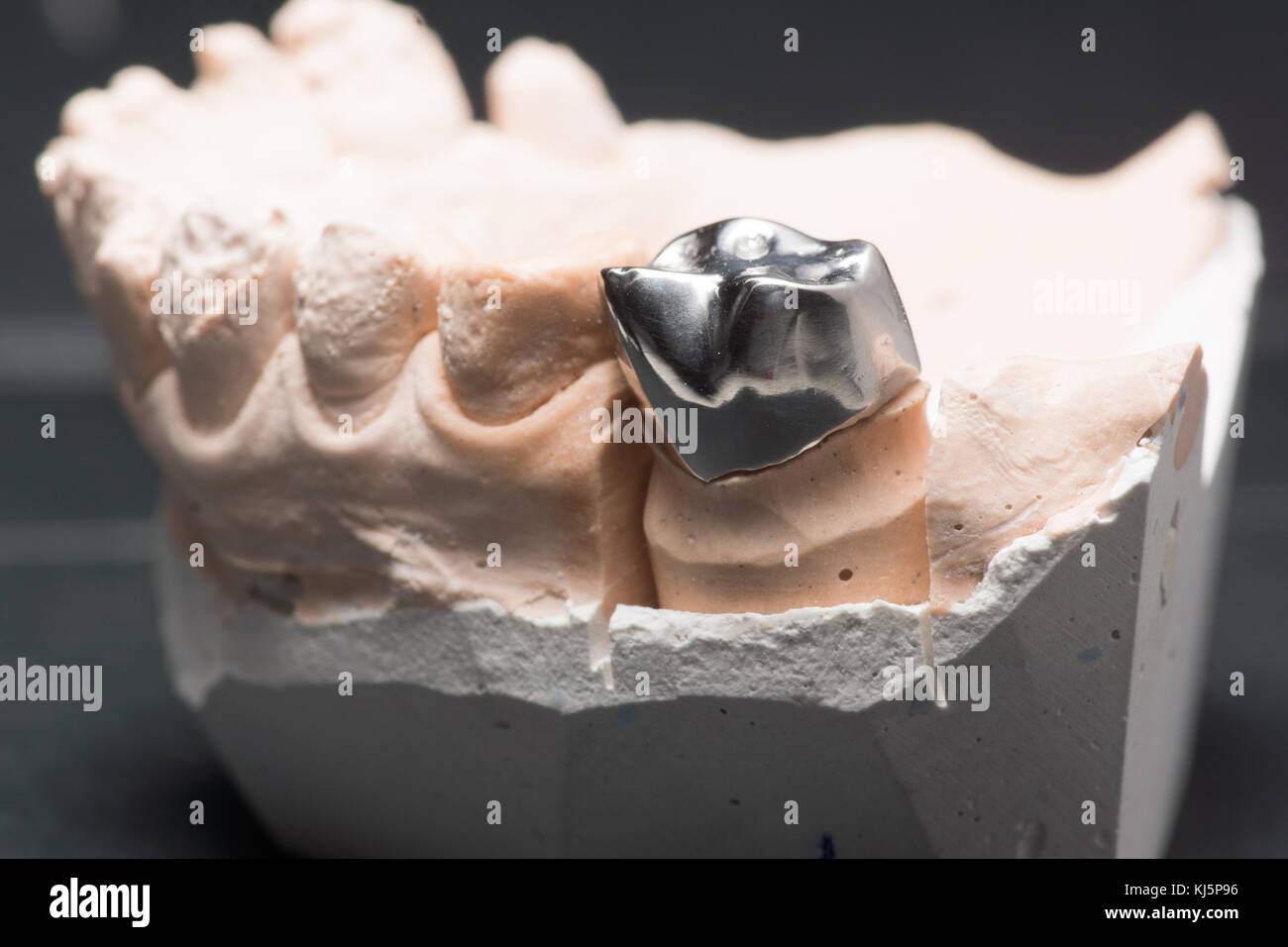 Steel artificial dental crown for dentition restoration Stock Photo - Alamy