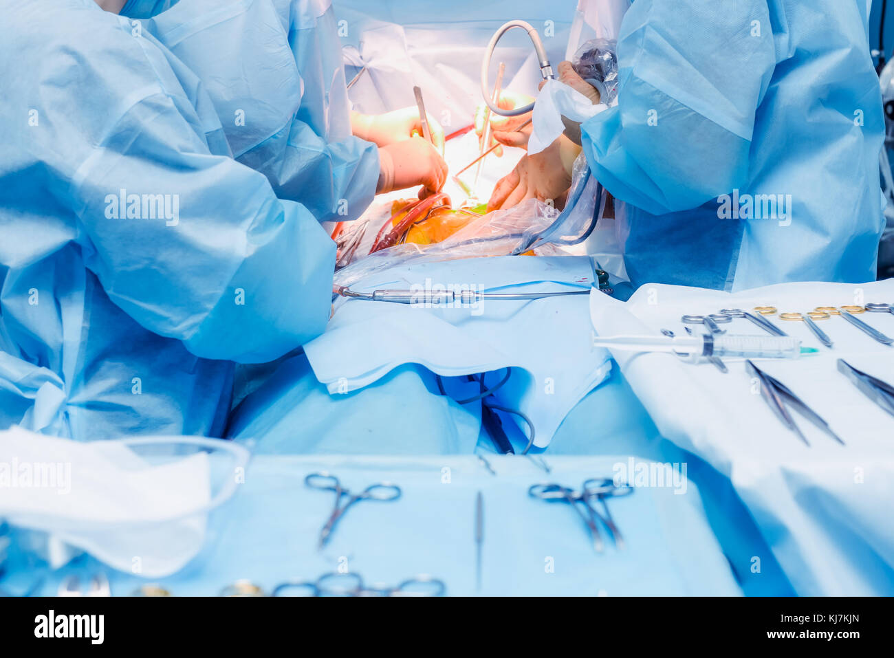 Close up surgical operation using laparoscopic equipment in modern ...