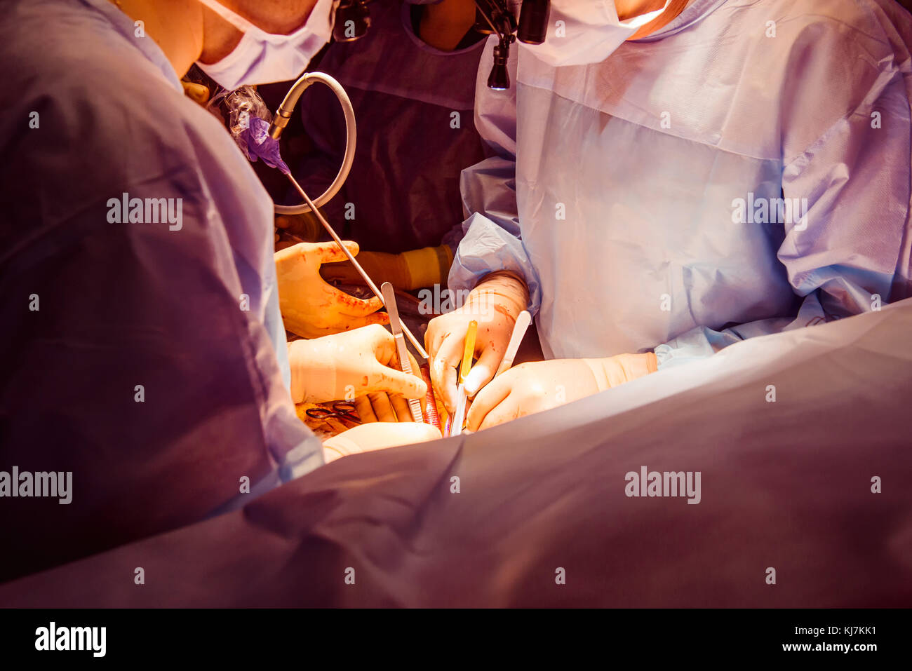 Peritoneal Cavity High Resolution Stock Photography and Images - Alamy