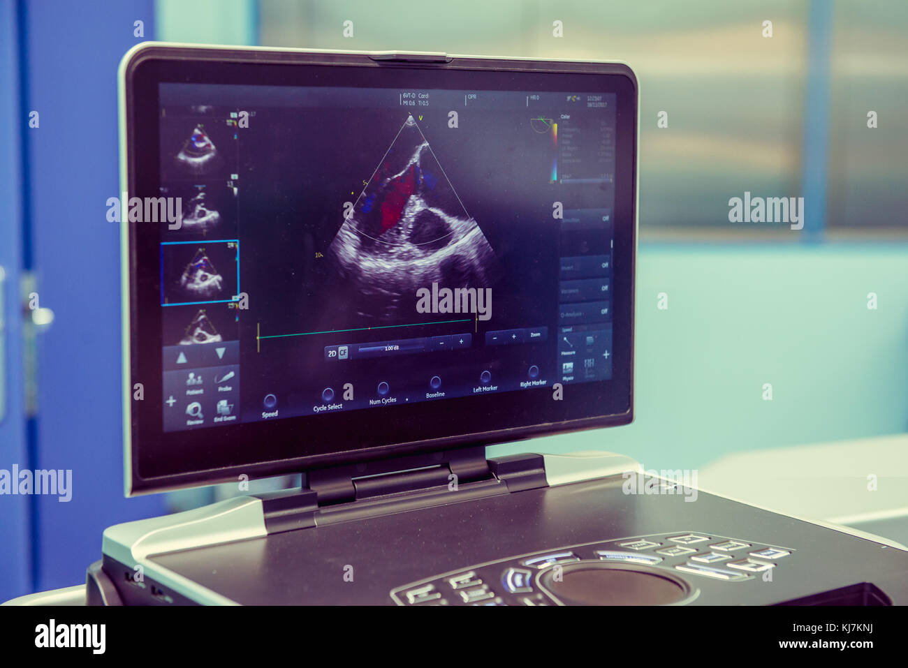 Echogram scan hi-res stock photography and images - Alamy