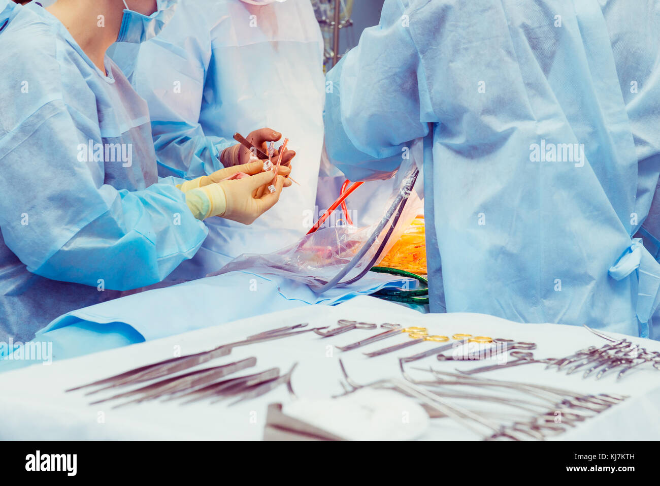 The assistant hands the receiver to the surgery doctor performing ...