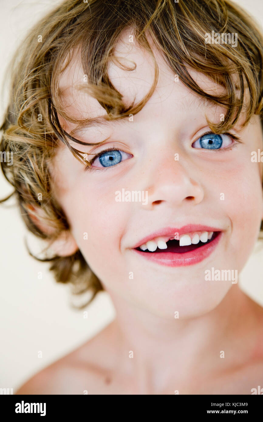 Boy With Missing Tooth Stock Photo - Alamy