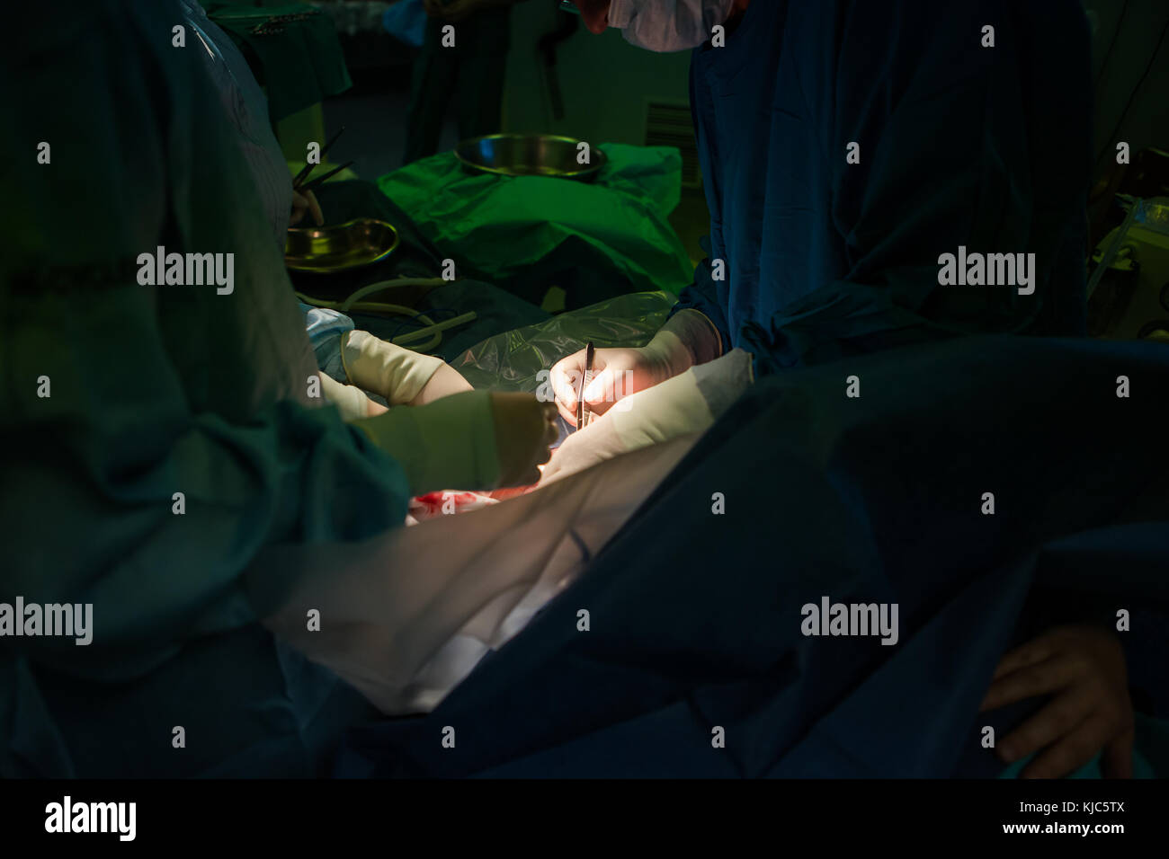 Close up image of a doctor doing a spinal block epidural on a pregnat ...