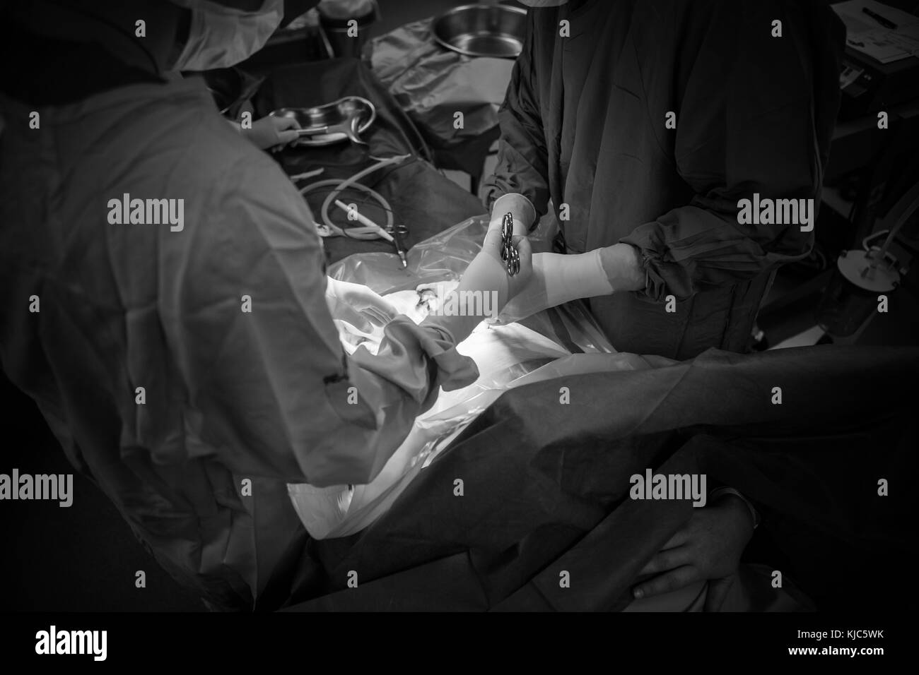 Close up image of a doctor doing a spinal block epidural on a pregnat ...