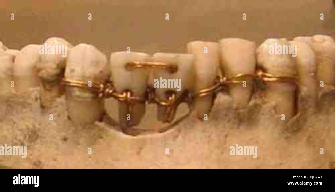 A reference to ancient Egyptian practices of dentistry. This could ...