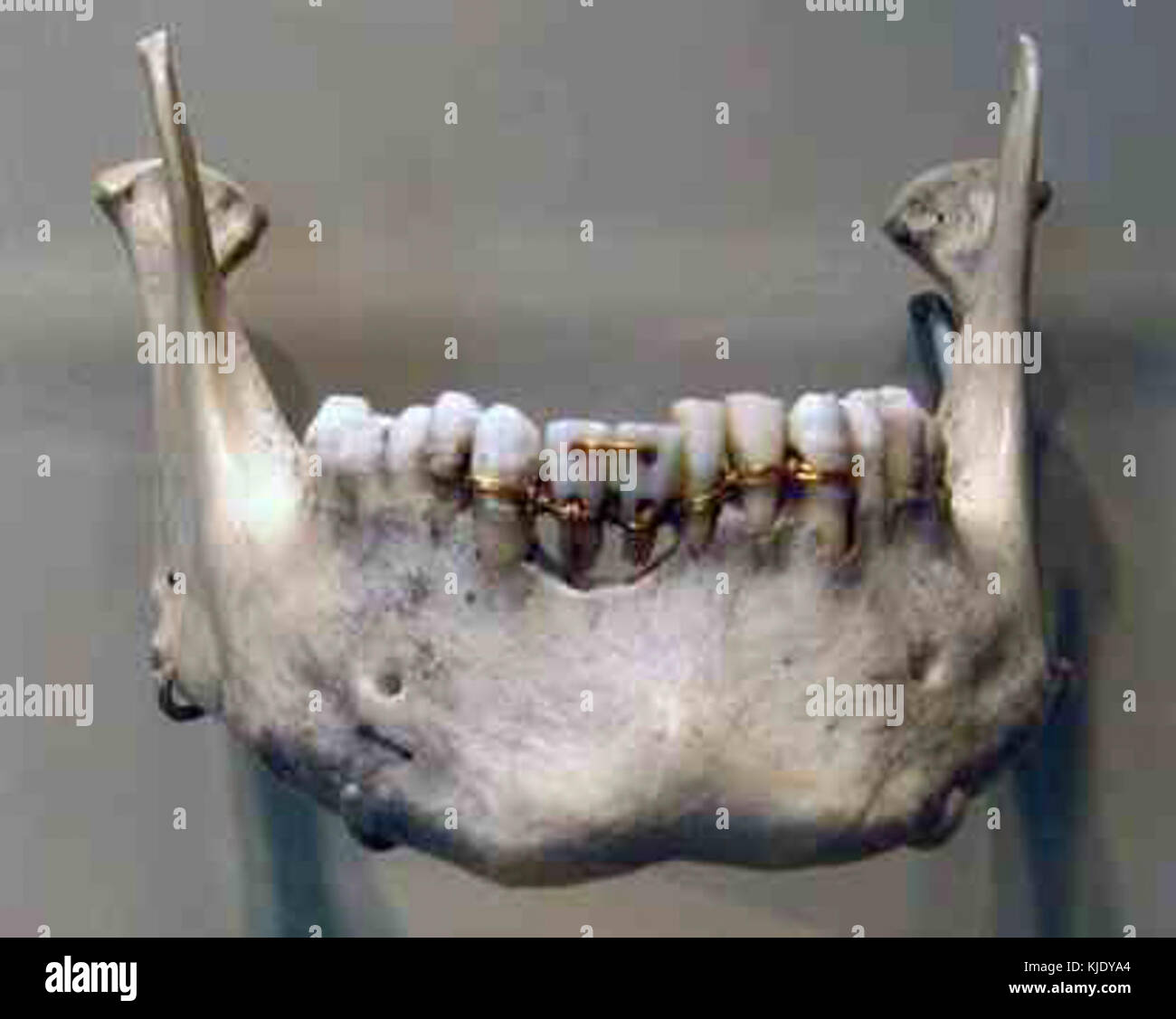 Ancient Egypt Dentistry2 Stock Photo - Alamy