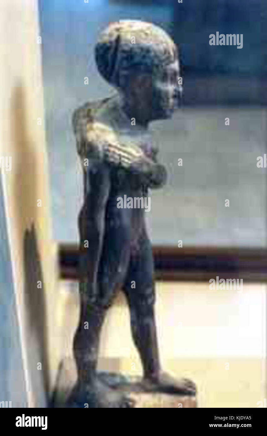 Kyphosis Stock Photos & Kyphosis Stock Images - Alamy