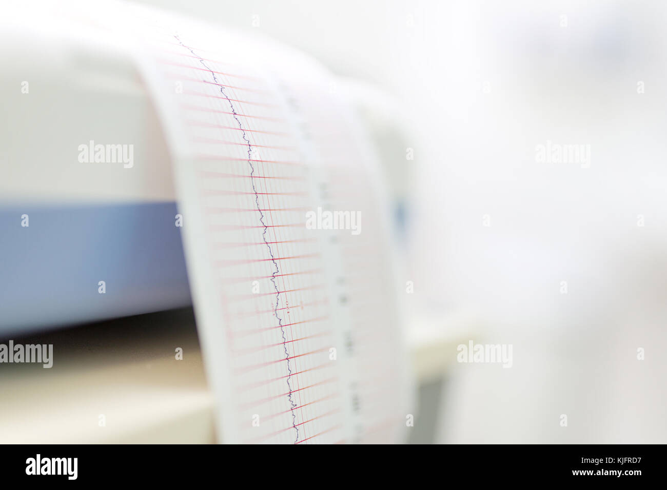 Cardiotocograph device in a hospital to examine fetus heartbeat and ...