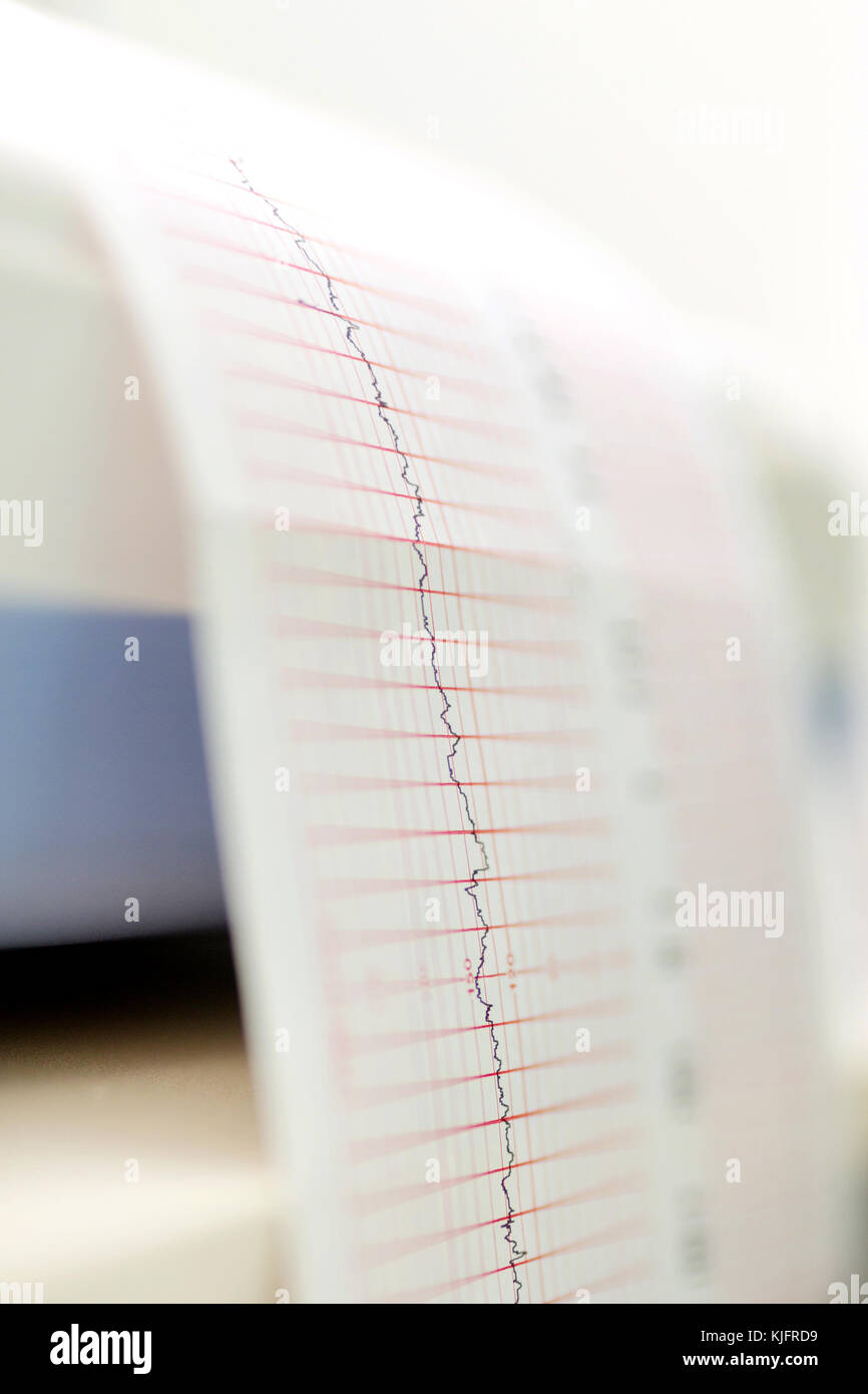 Cardiotocograph hi-res stock photography and images - Alamy