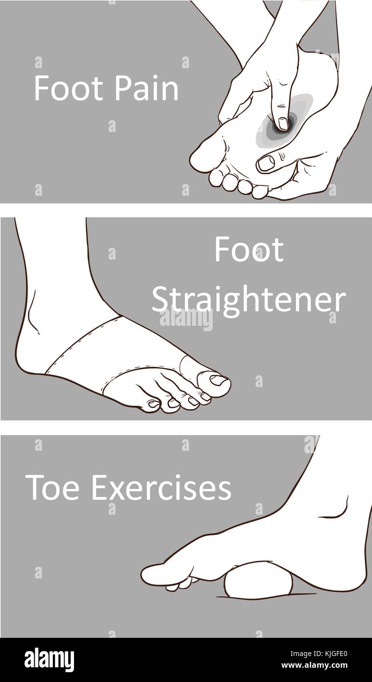 vector illustration of a Foot health Stock Vector Image & Art - Alamy
