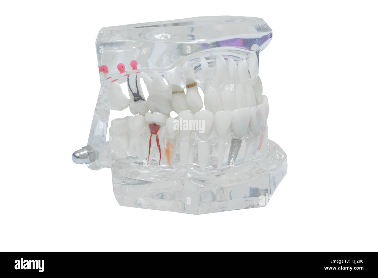 Dental Model of Teeth,Isolated on white background clipping path , in ...