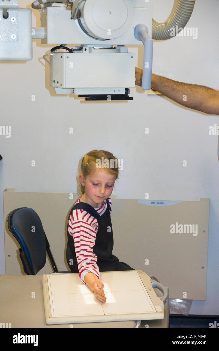 Broken arm xray hi-res stock photography and images - Alamy