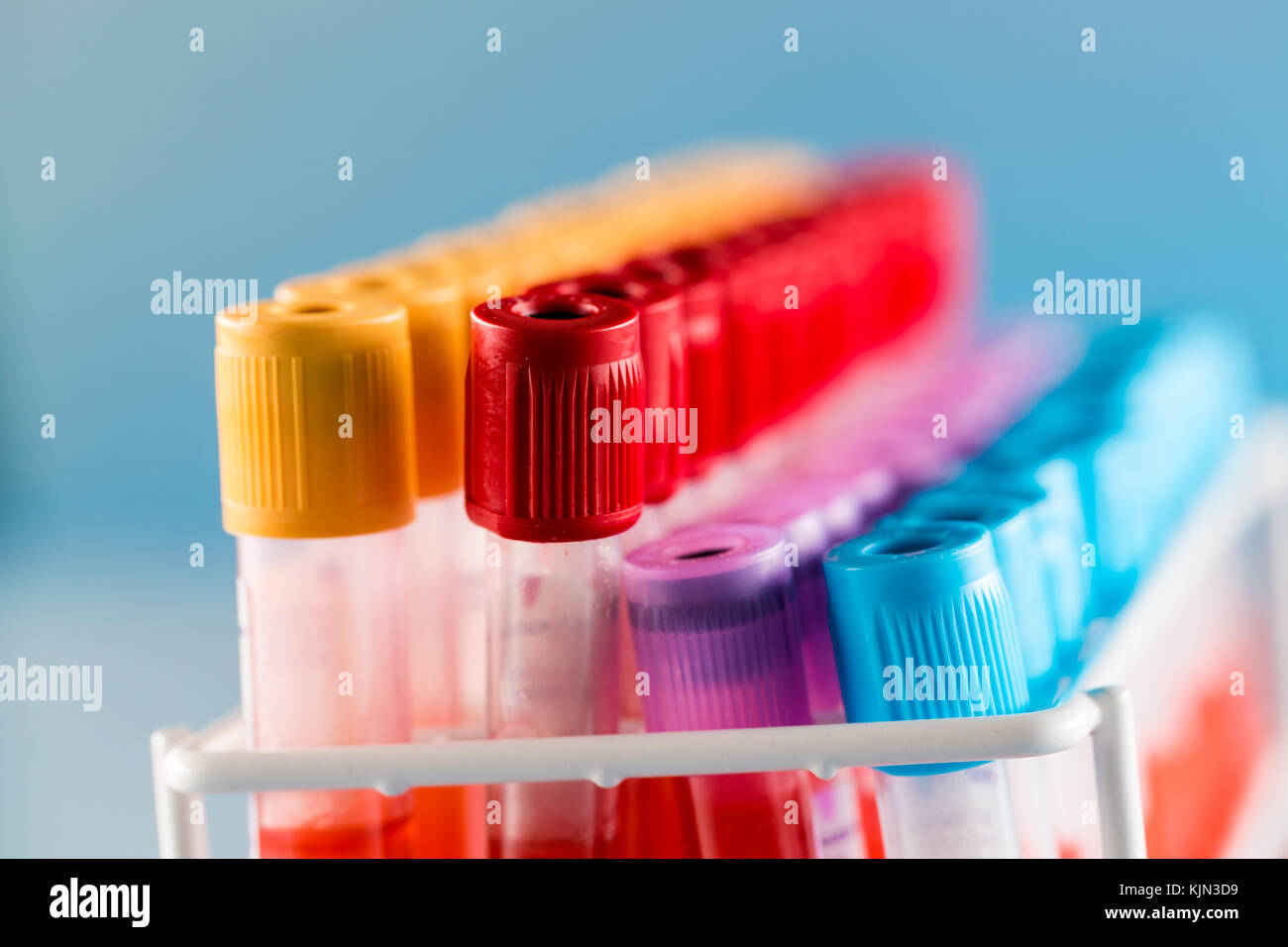 Test tubes with blood for medical and biological analyzes Stock Photo ...