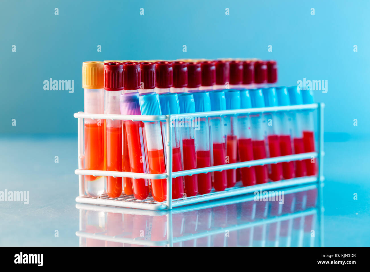 Test tubes with blood for medical and biological analyzes Stock Photo ...