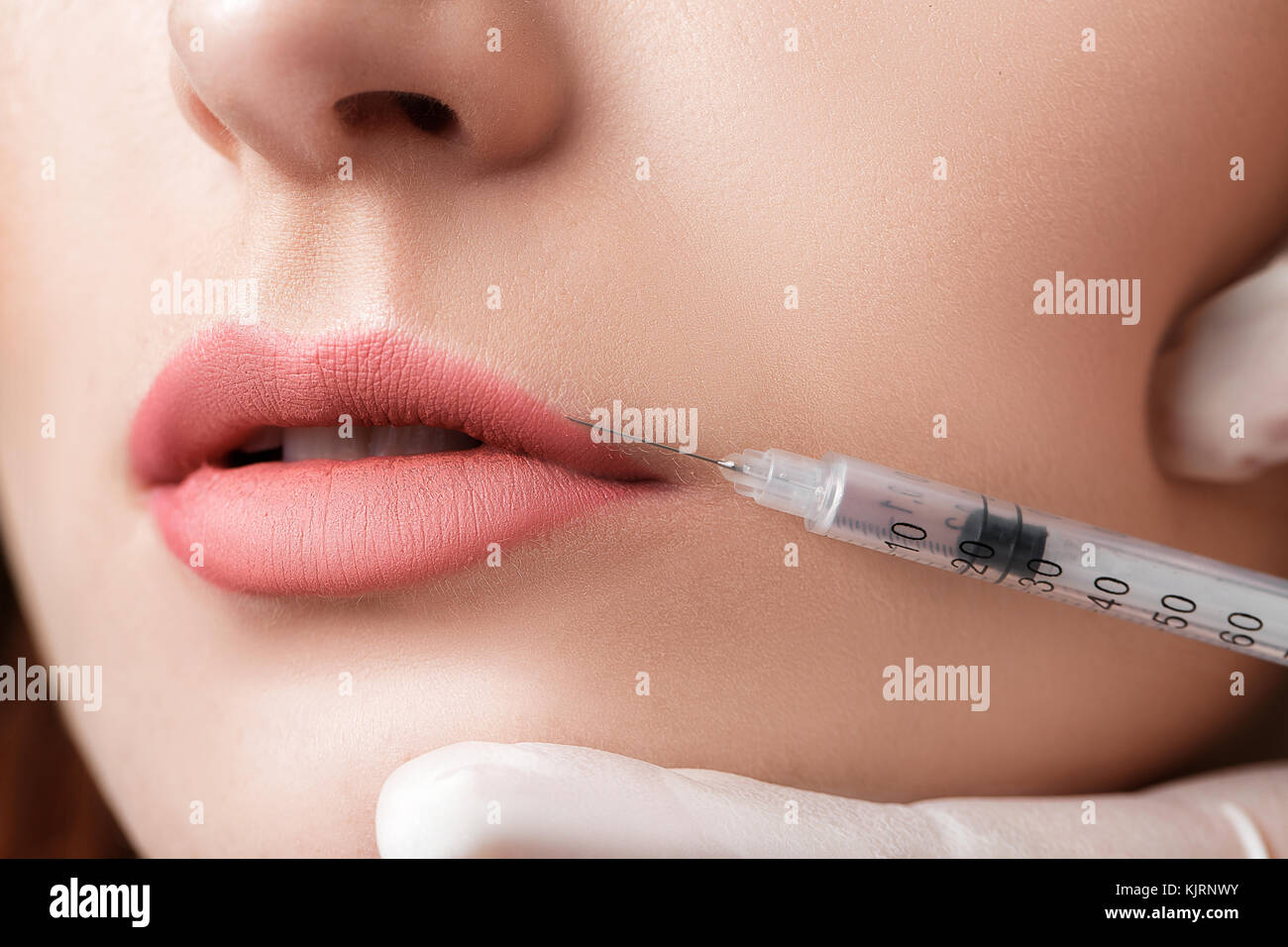 woman getting injection on lips Stock Photo - Alamy