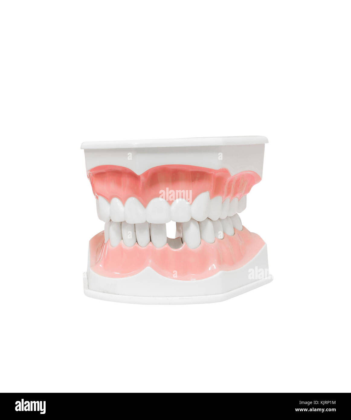 Dental Model of Teeth , and broken tooth , Isolated on white background ...