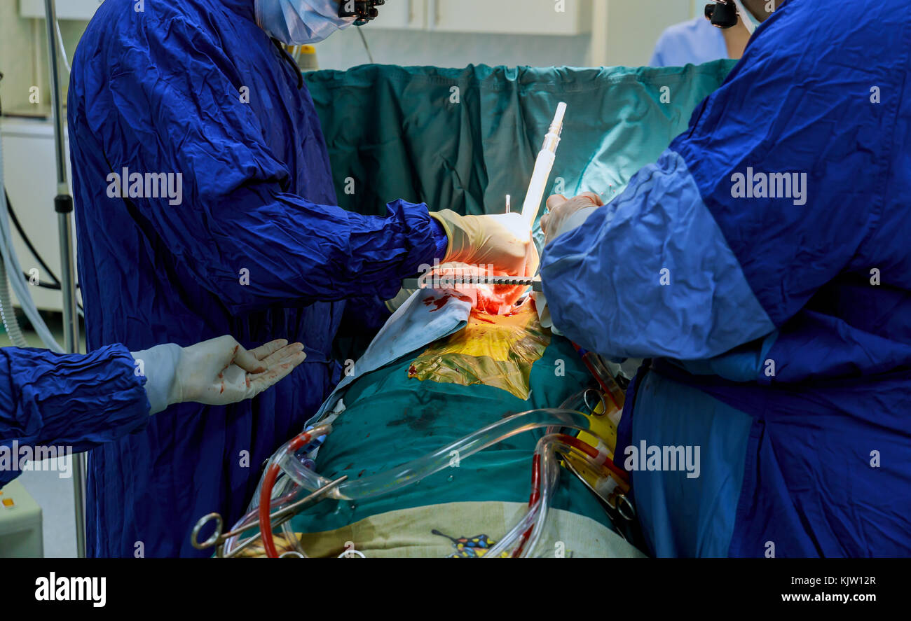 Doctor, operating room hi-res stock photography and images - Alamy