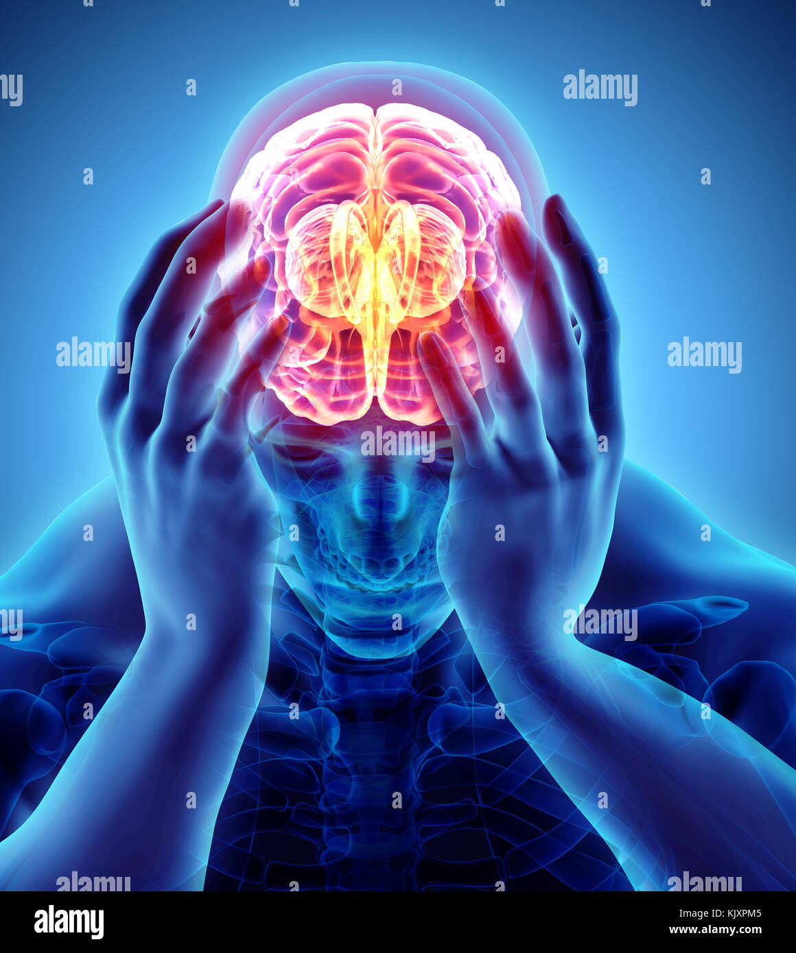3d illustration of headache human, x-ray medical concept Stock Photo ...