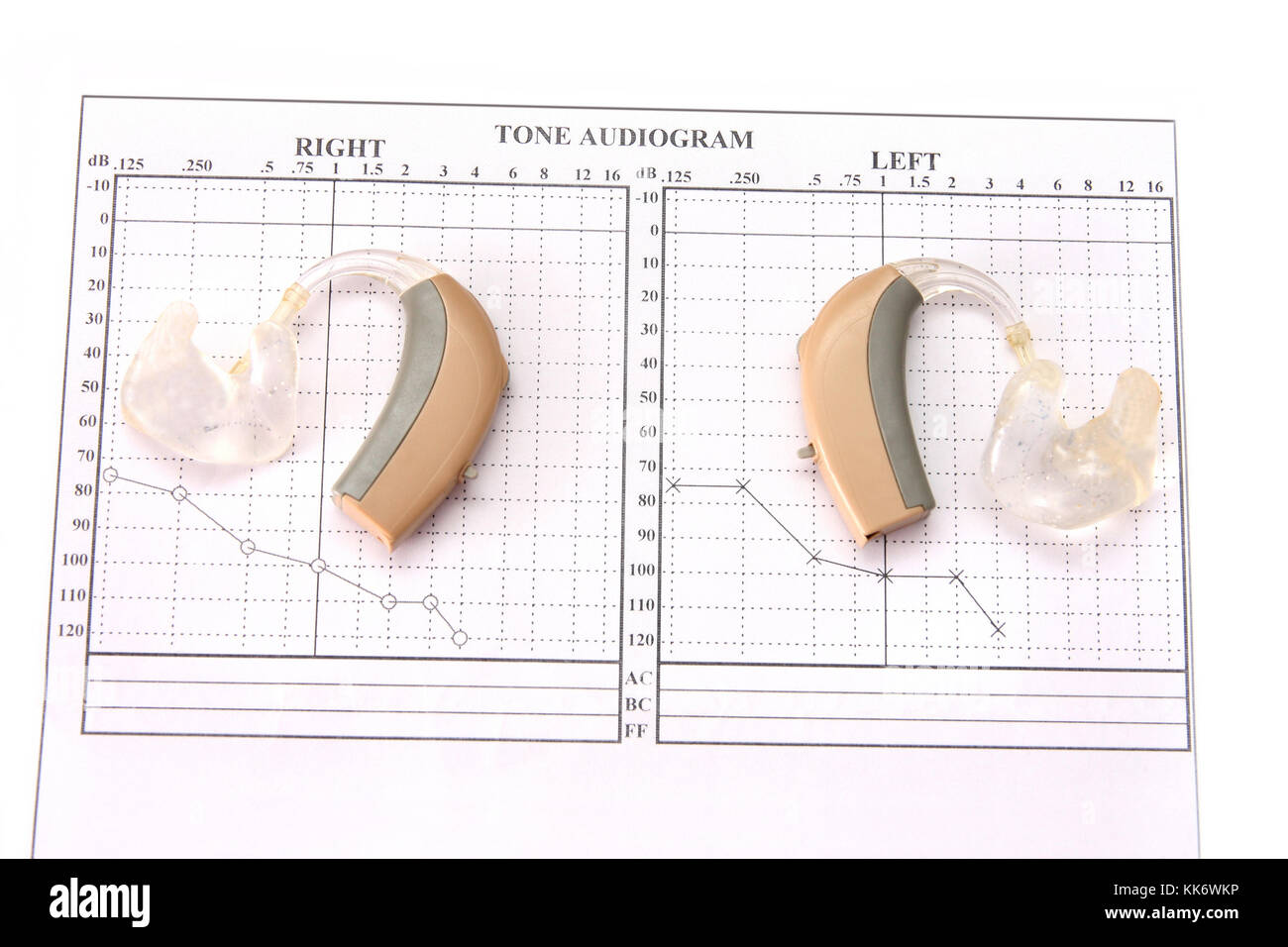 Hearing medical chart showing and hearing aid Stock Photo - Alamy