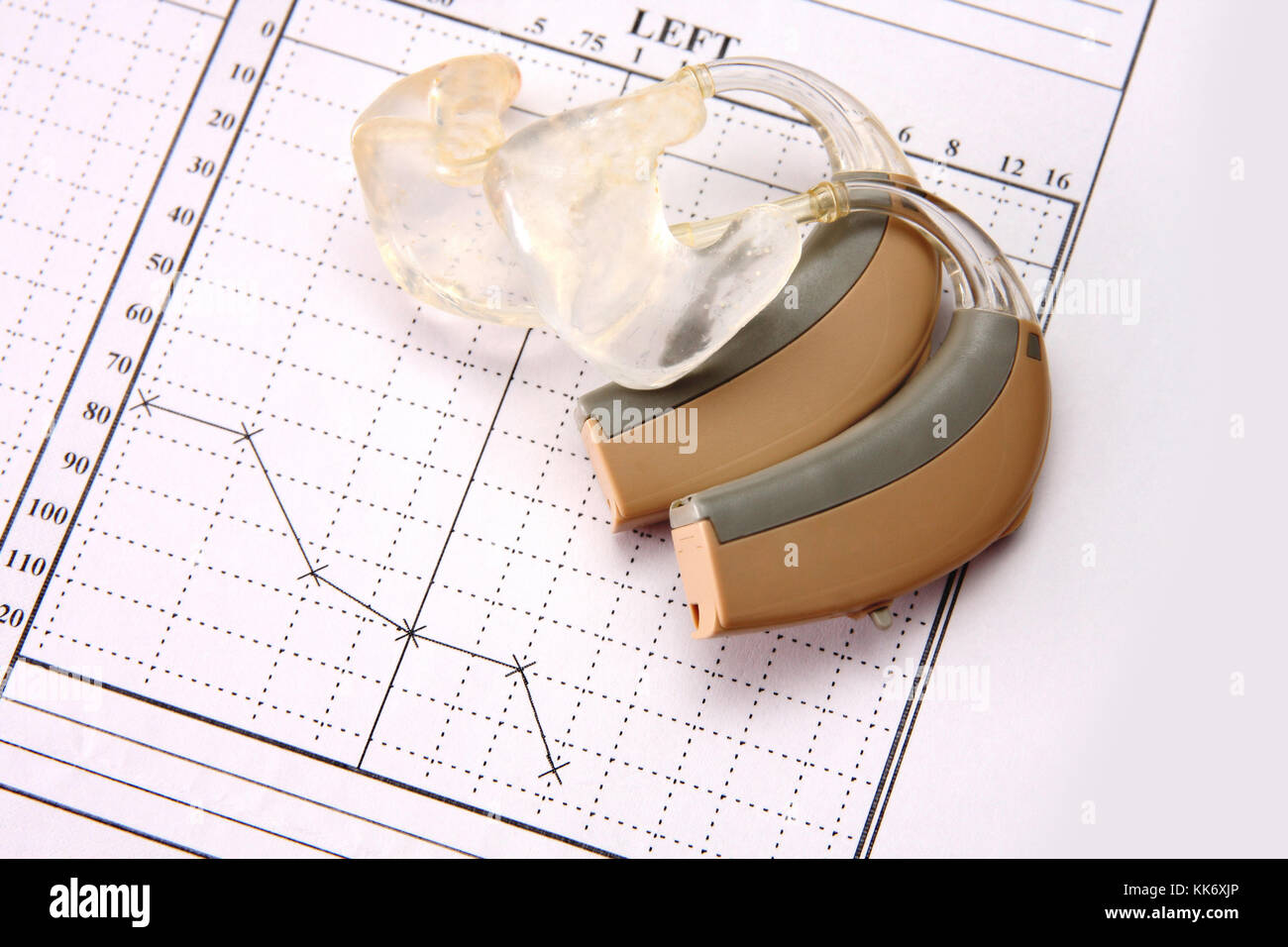 Hearing medical chart showing and hearing aid Stock Photo - Alamy