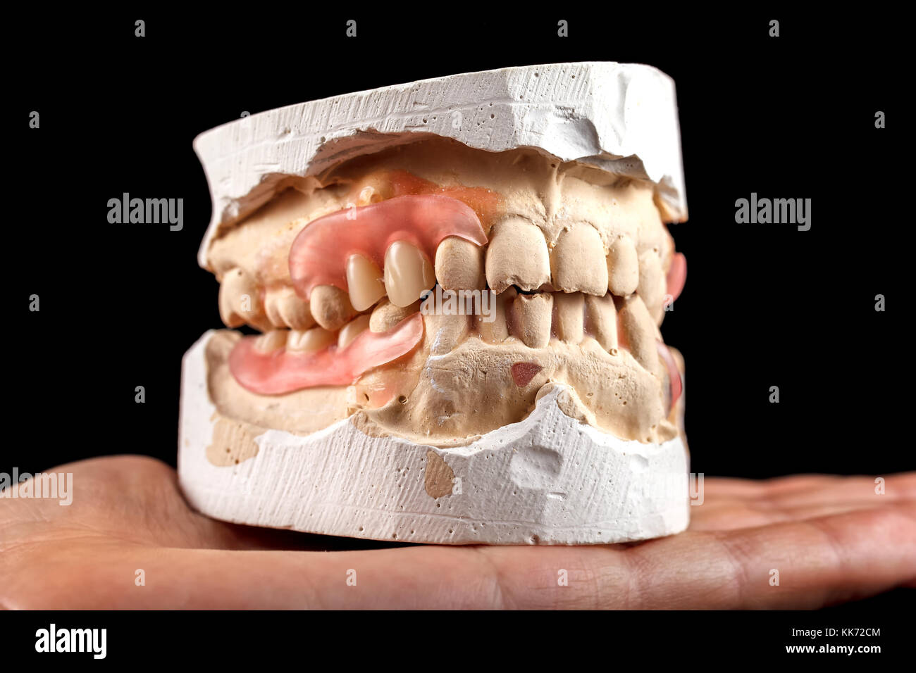 Prosthetic base hi-res stock photography and images - Alamy