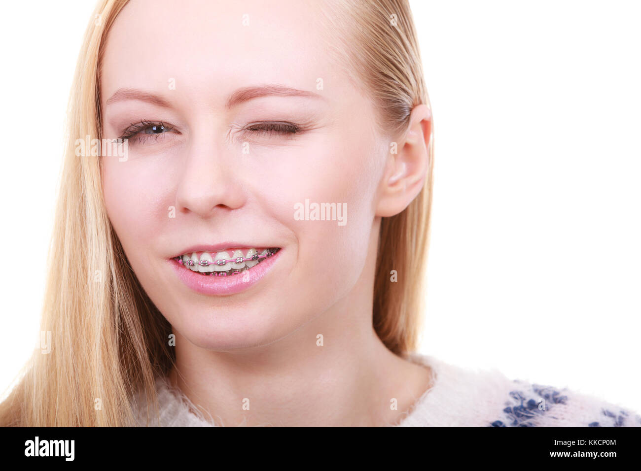 Orthodontist dentistry treatment concept. Happy smiling woman showing ...