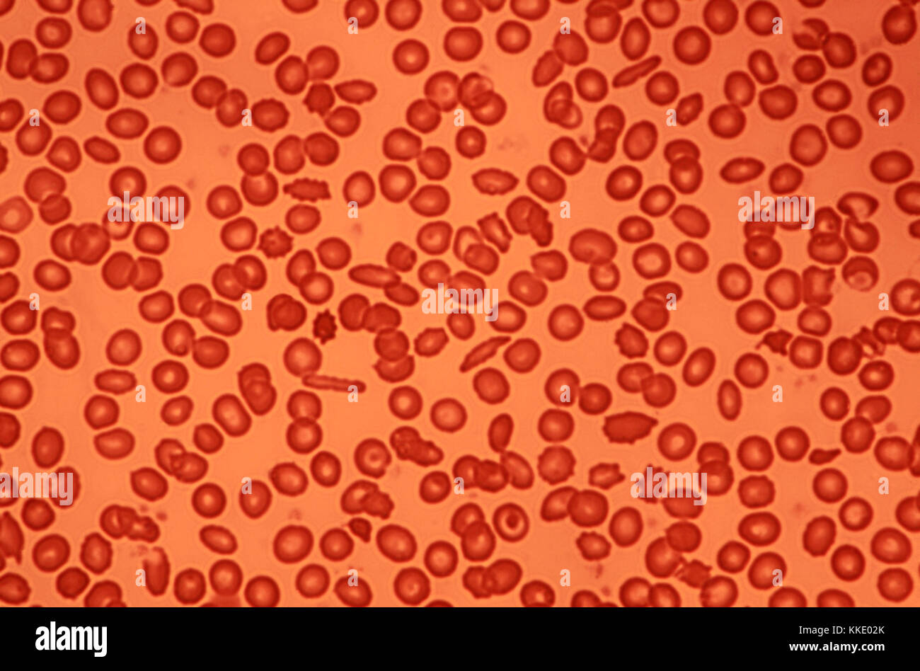 Medicine - Human Blood Cells photographed using a microscope Stock ...