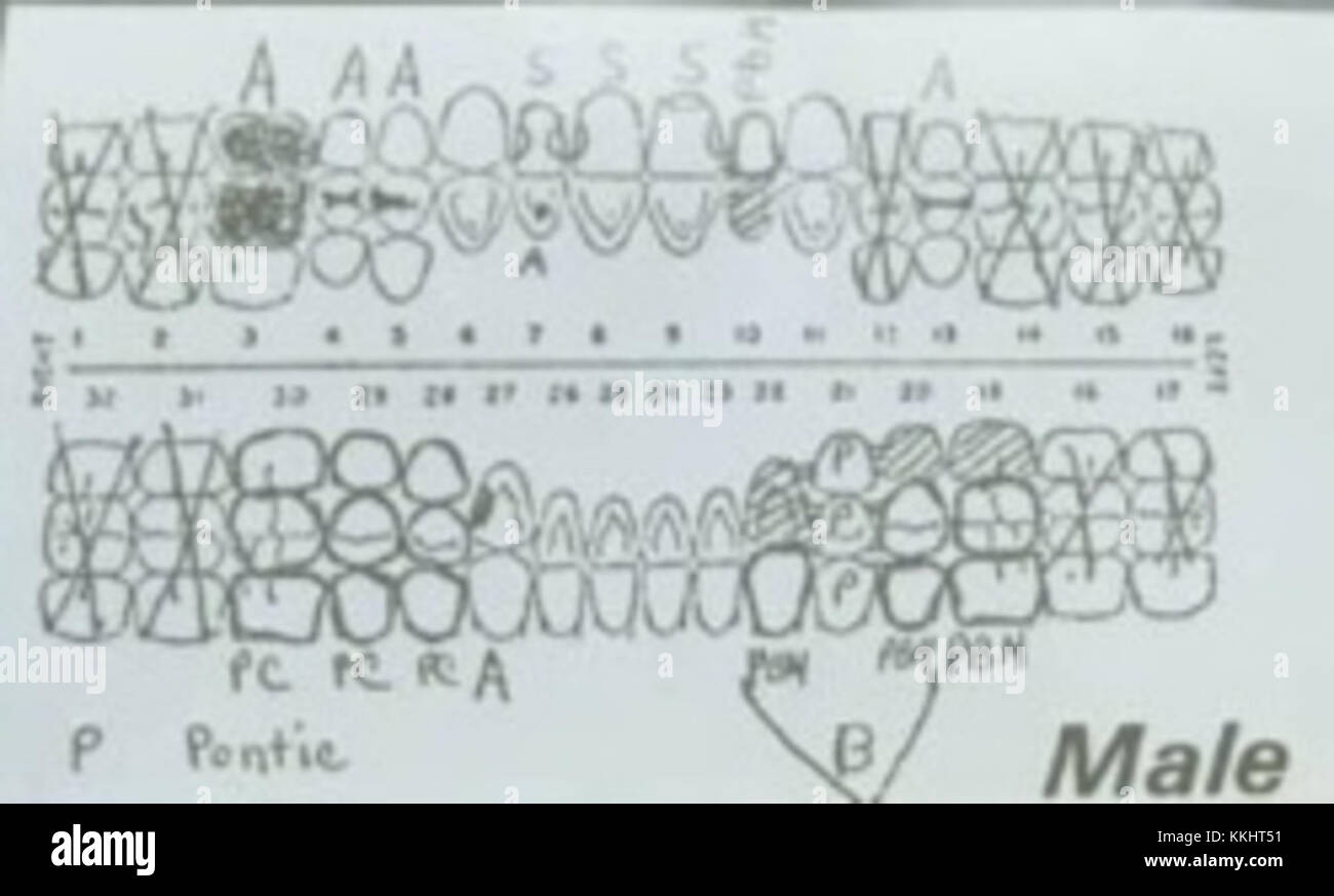 Forensic sketch male hi-res stock photography and images - Alamy