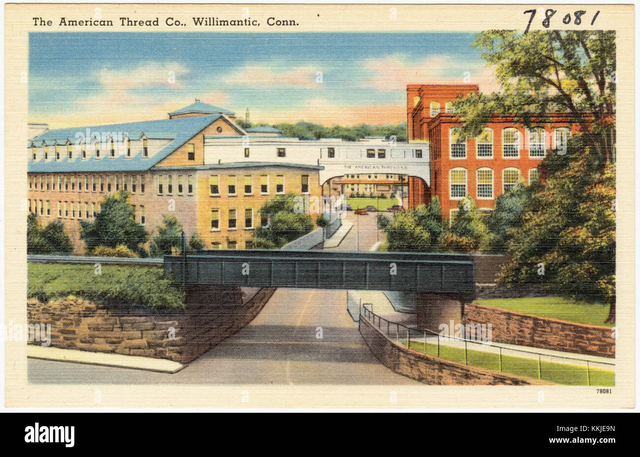 American thread hi-res stock photography and images - Alamy