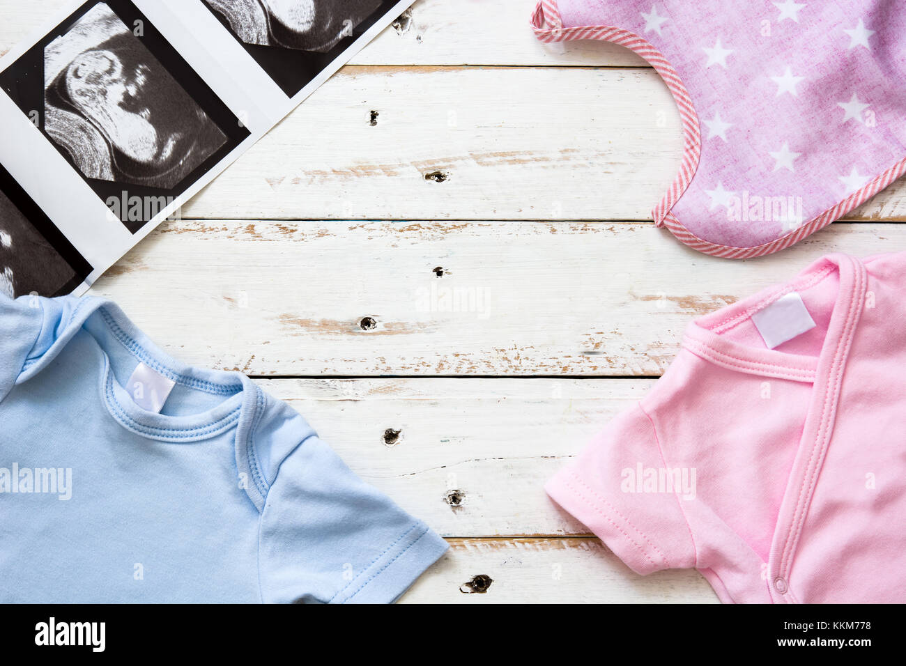 Pink and blue baby romper and ultrasound on white wooden background ...
