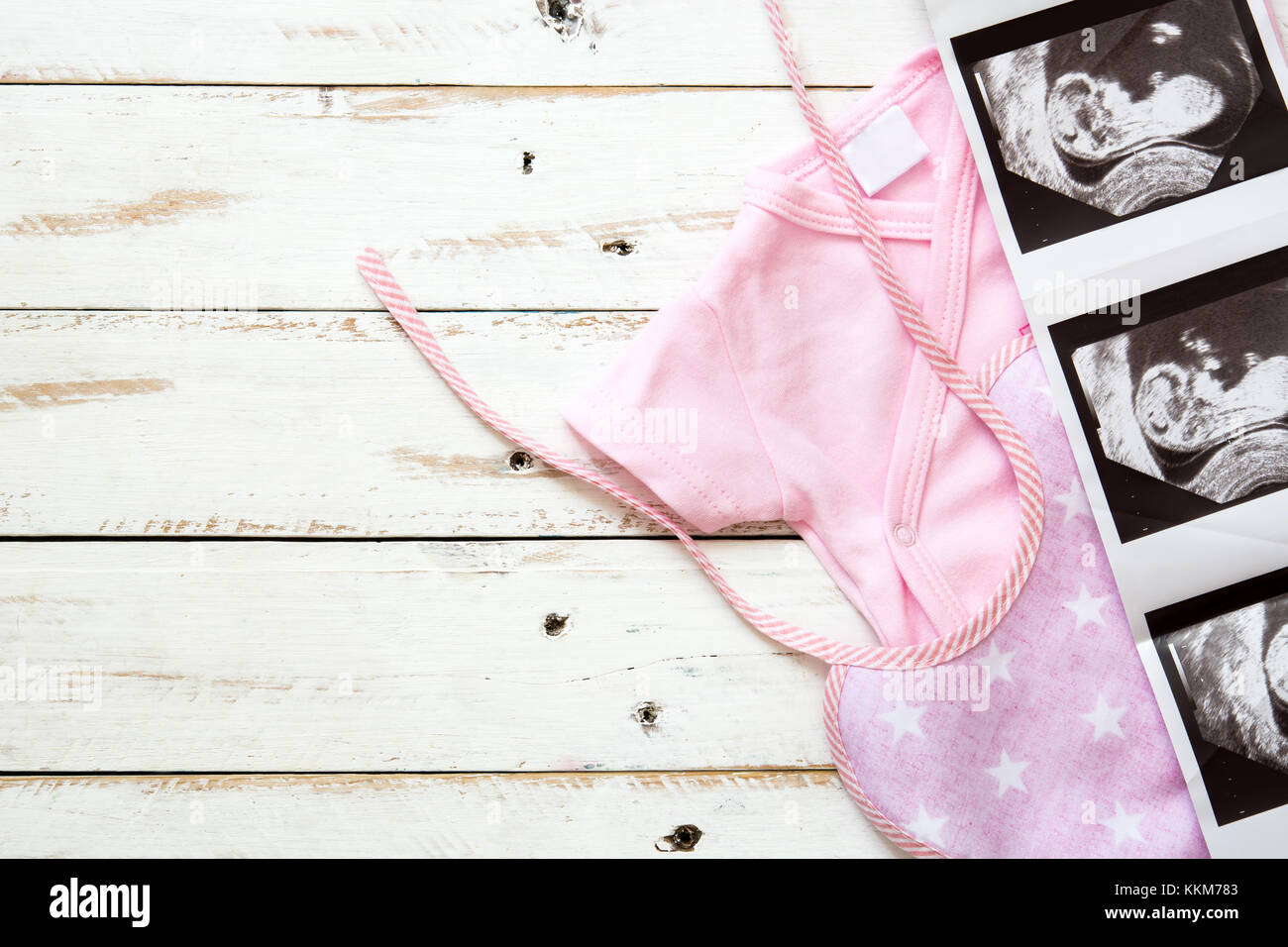 Newborn ultrasound hi-res stock photography and images - Alamy