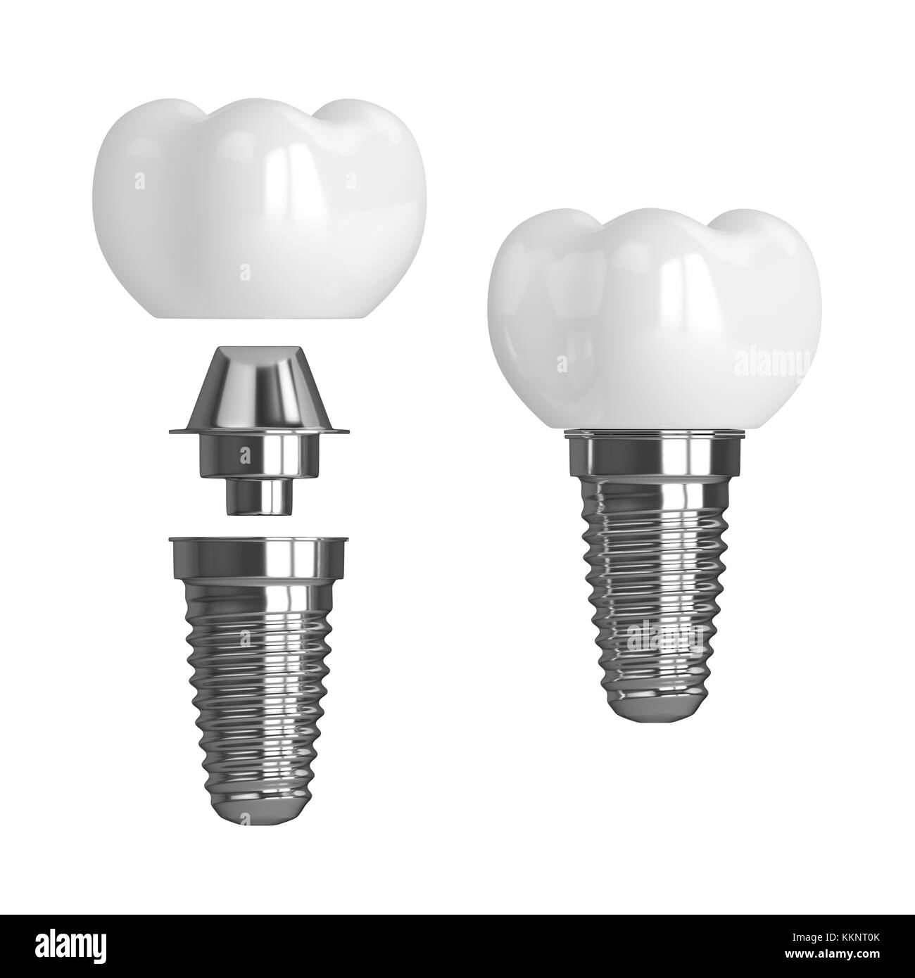 3d render of dental implants isolated over white background Stock Photo ...