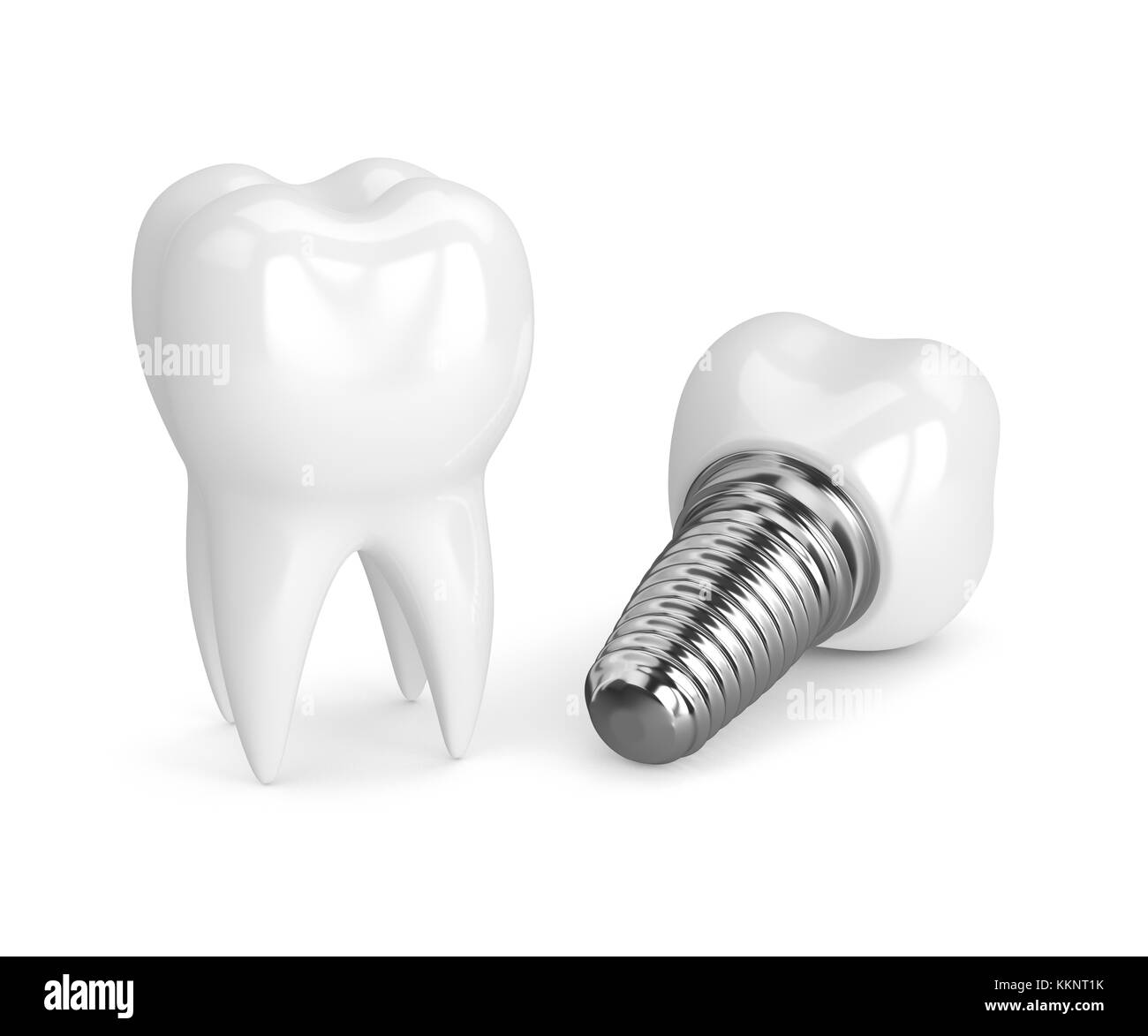 Dental Implant Background
