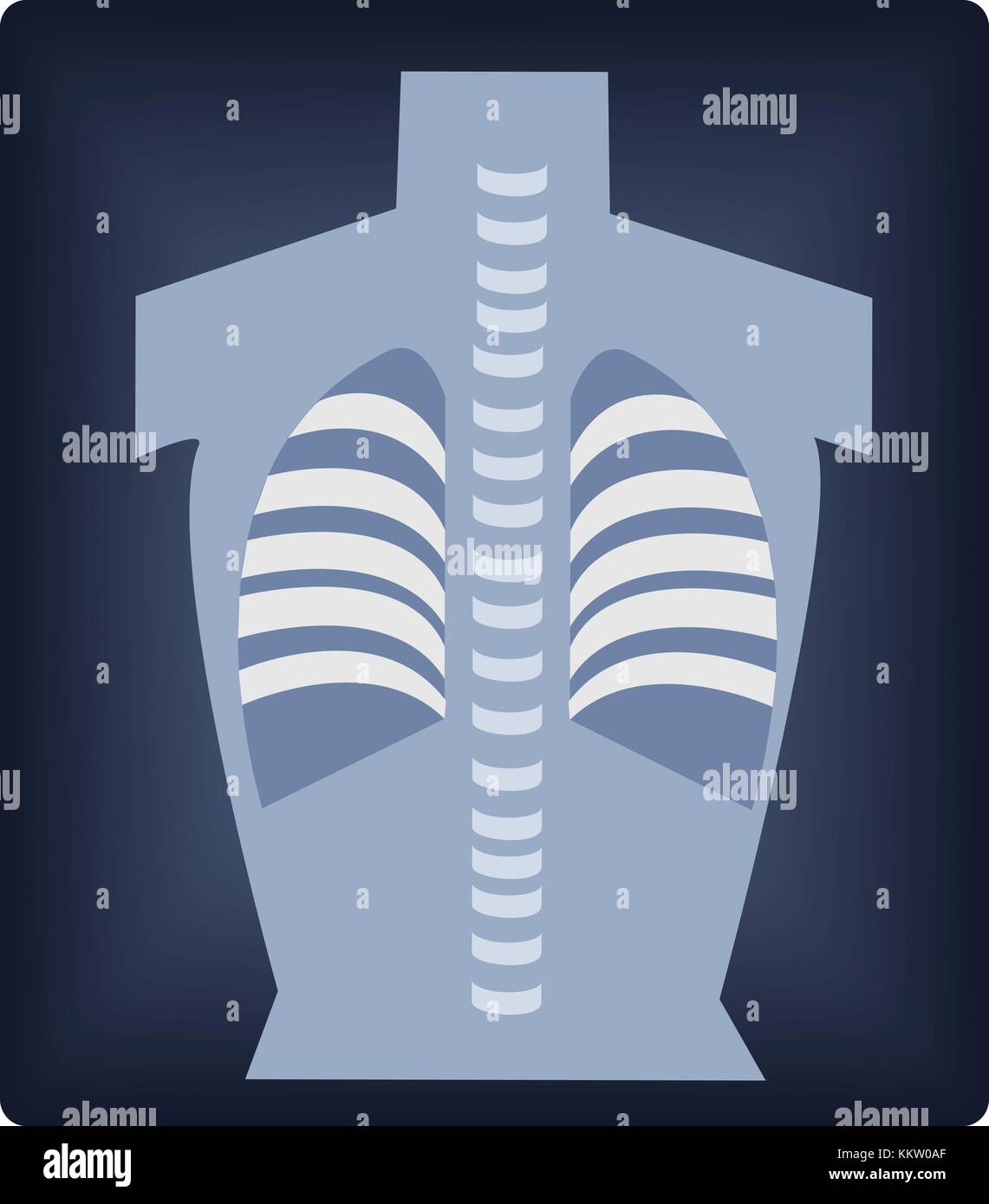 Chest imaging hi-res stock photography and images - Alamy