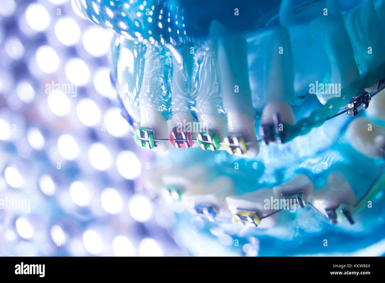 Dental teeth retainers metal aligners brackets to straighten teeth in ...