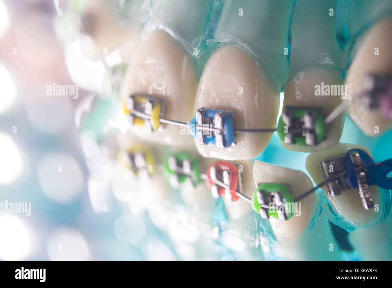 Dental teeth retainers metal aligners brackets to straighten teeth in ...