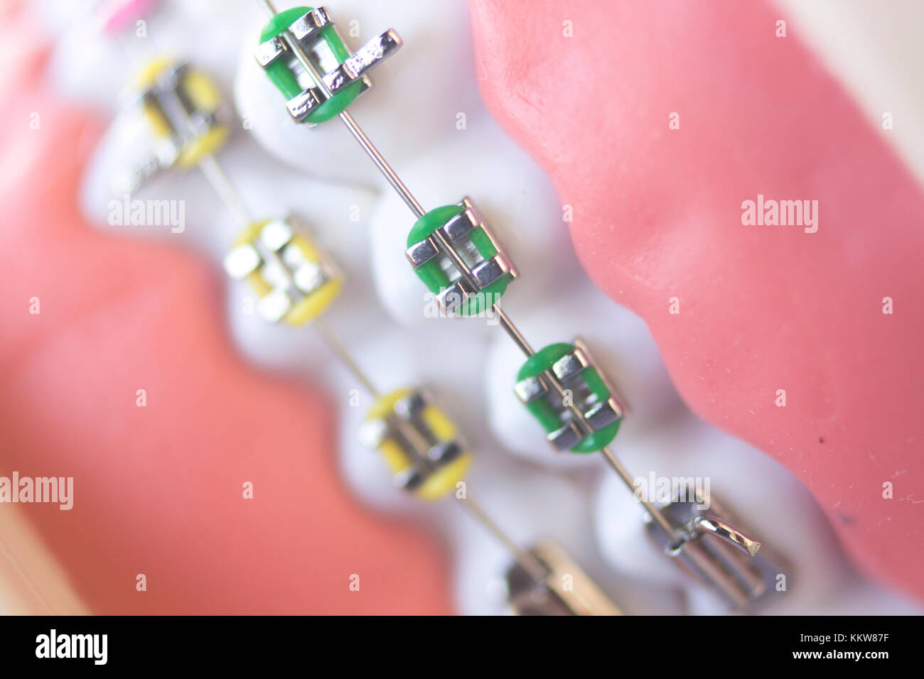 Cosmetic dentistry orthodontics dental metal wire teeth brackets ...