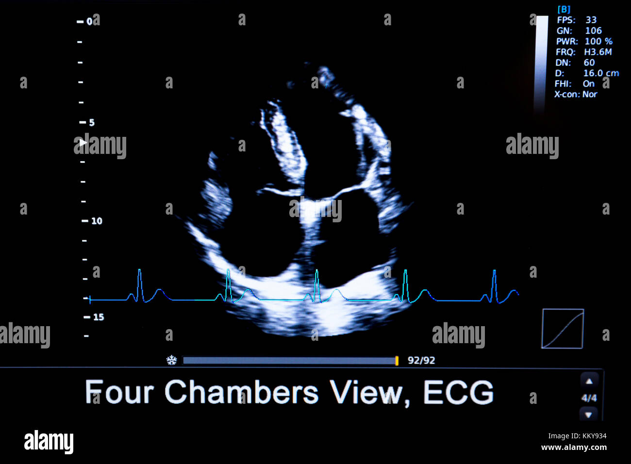 Colourful image of modern ultrasound monitor. Ultrasonography machine ...