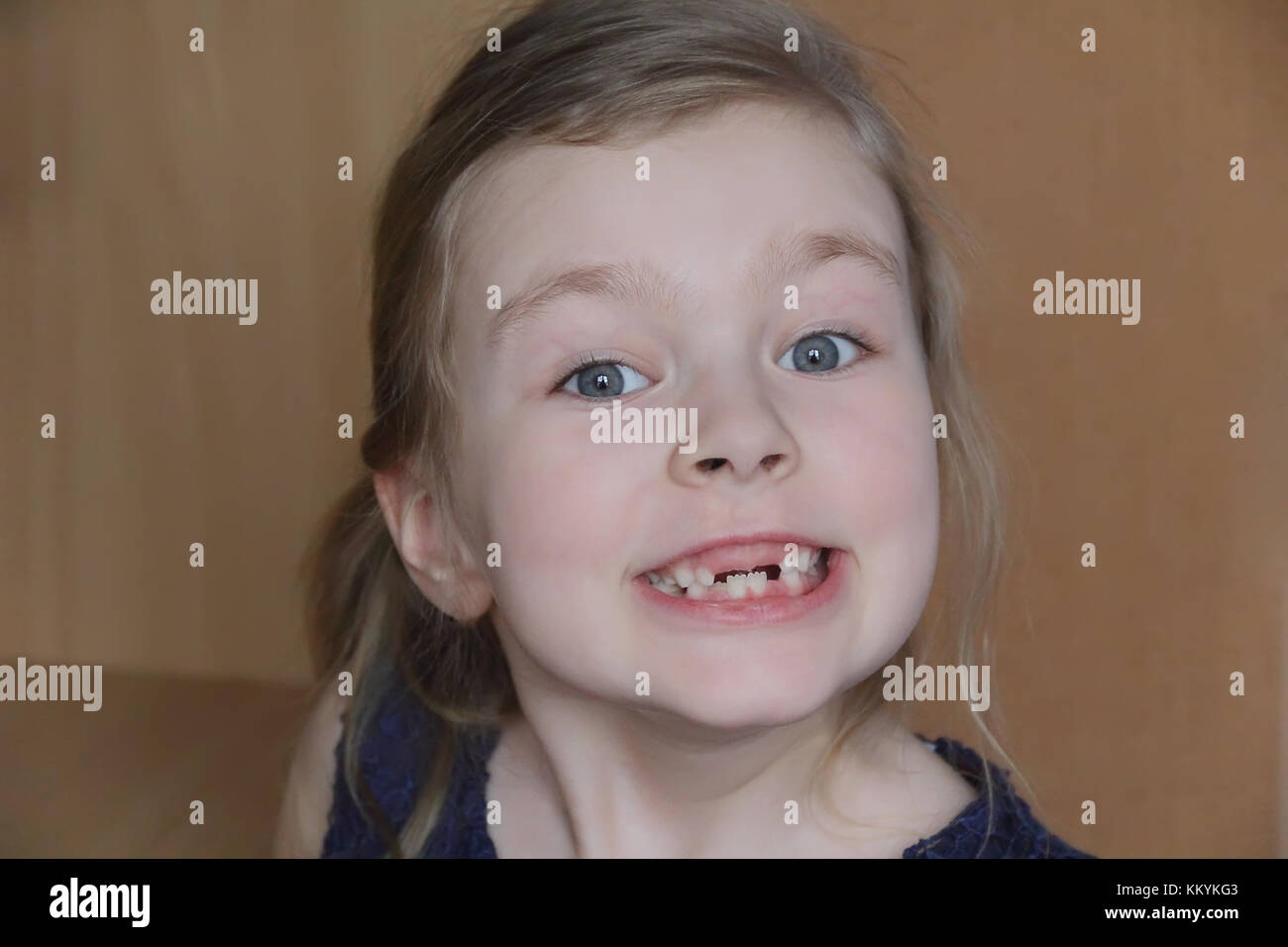Portrait of beautiful child without front teeth Stock Photo - Alamy