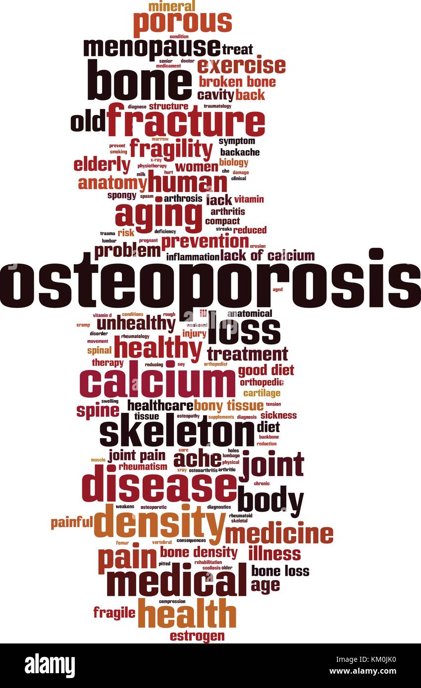 Bone fracture word cloud concept. Collage made of words about bone ...