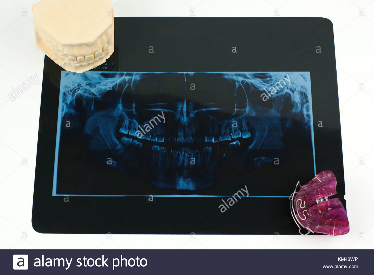 Radiograph Dental High Resolution Stock Photography and Images - Alamy