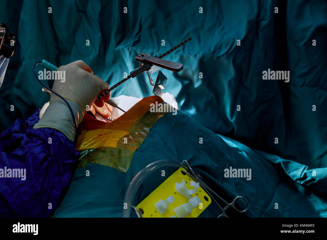 Blood blocks hi-res stock photography and images - Alamy