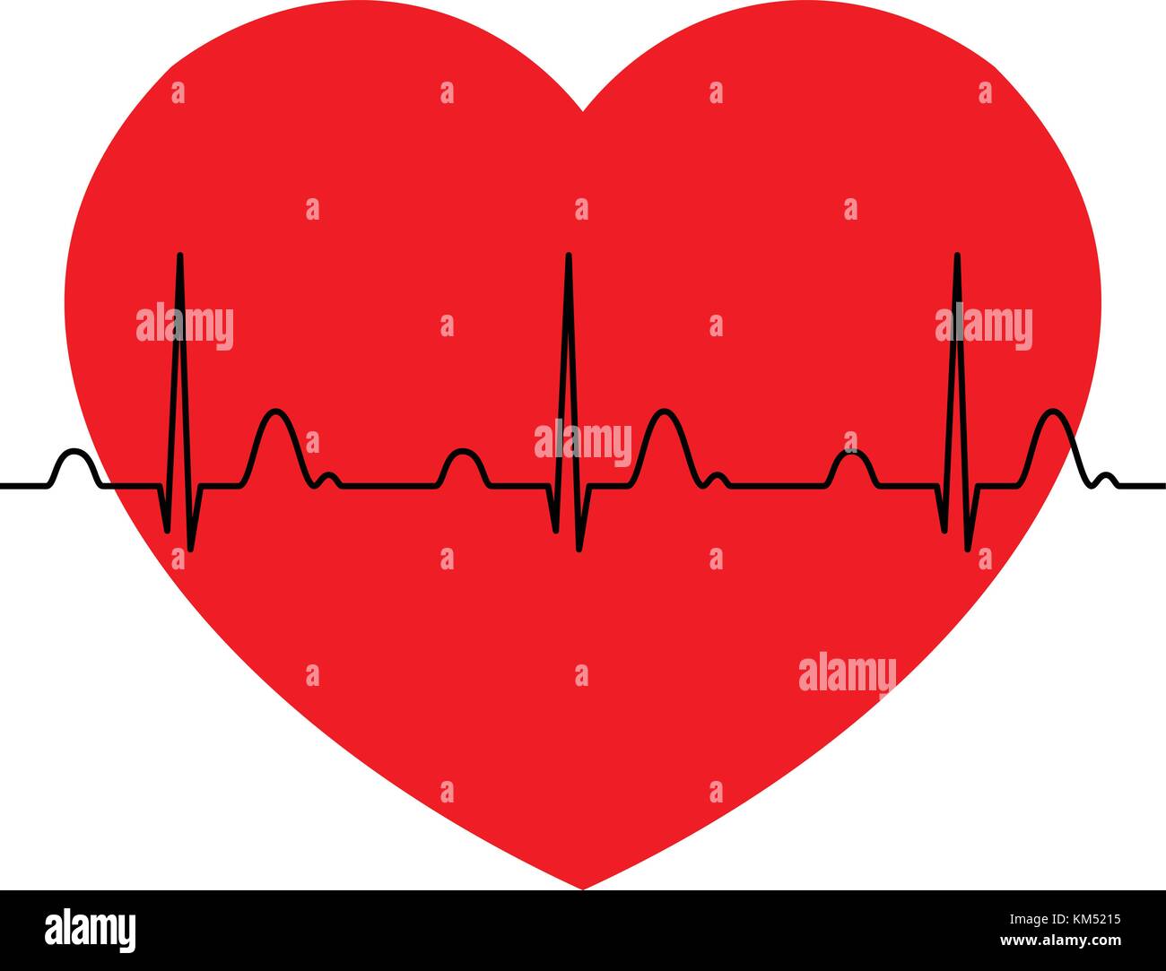 Normal ecg hi-res stock photography and images - Alamy